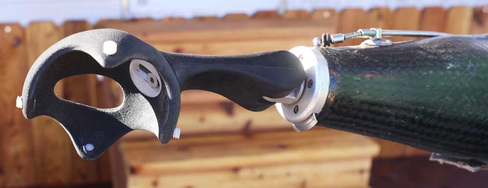 Shiloh Binder’s journey to recovery | Capital Press